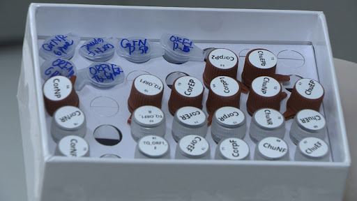 Sự khác biệt giữa test kit của Hàn Quốc và test kit của Việt Nam?